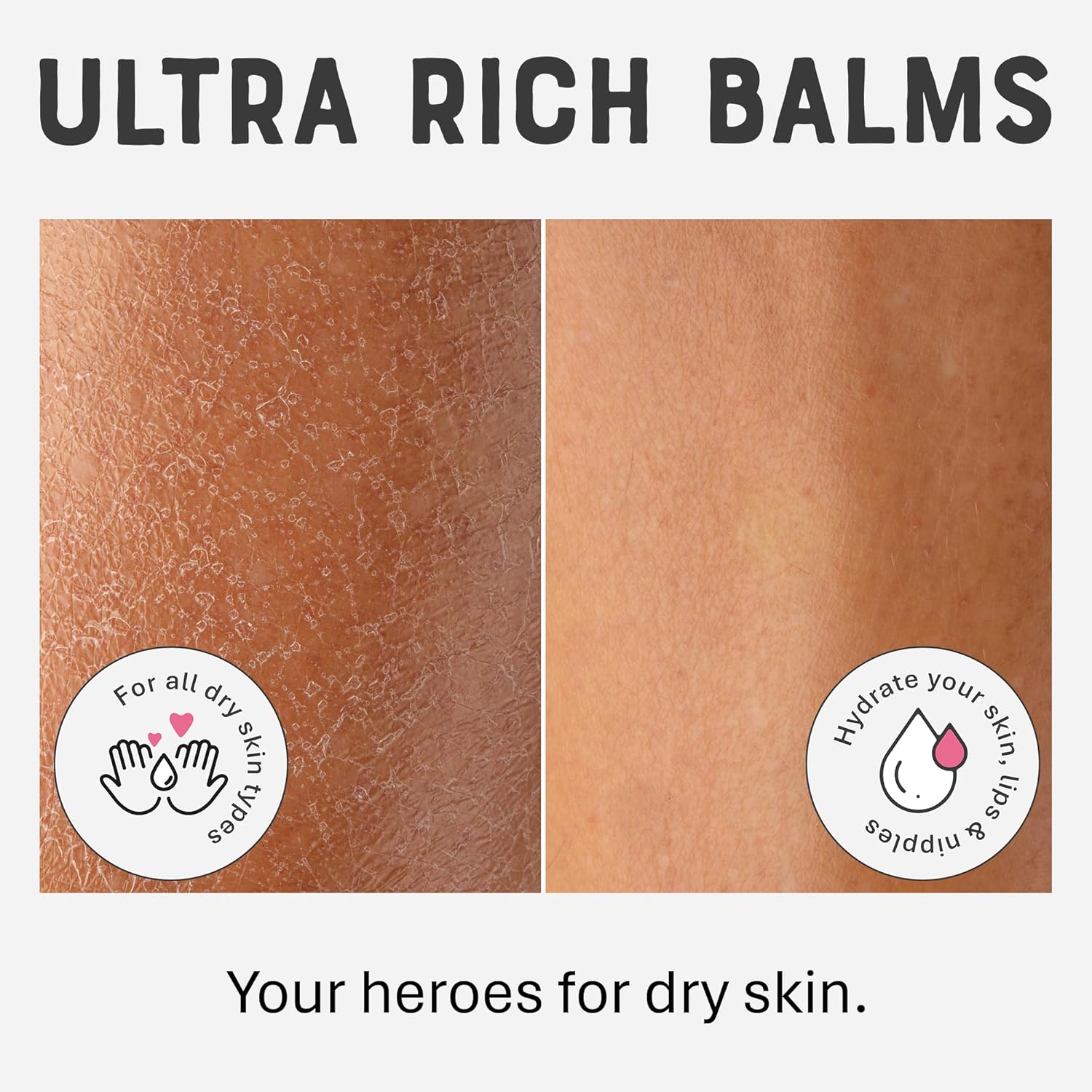 Dr.Lipp BFF Balm - Face, Hand, Foot & Body Butter – liquidation.store